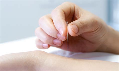 Welcome Beijing Acupuncture Chinese Medicine