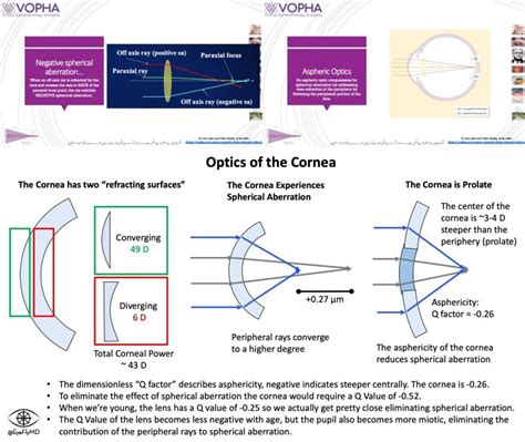 Spheric Aspheric And Prolate Cornea Topography Zia Ul Mazhry Posted On The Topic Linkedin