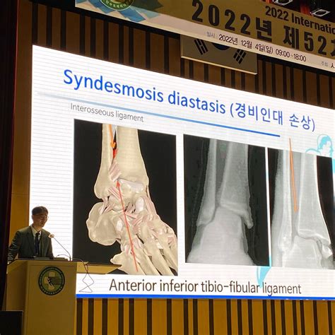 세종스포츠정형외과 대한선수트레이너협회 52차 정기심포지엄 김진수 원장 발표 주제