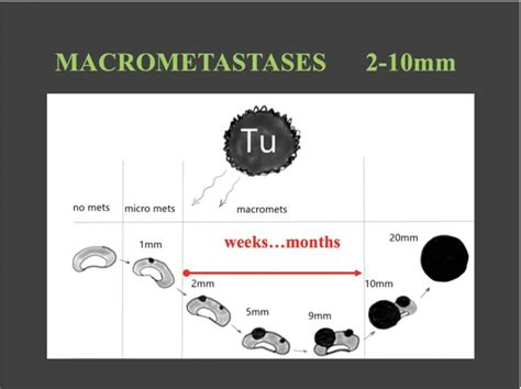 Ln Rads Cases Lymph Node Reporting And Data System Ln Rads