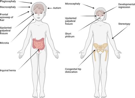 Frontiers Sex Difference Contributes To Phenotypic Diversity In