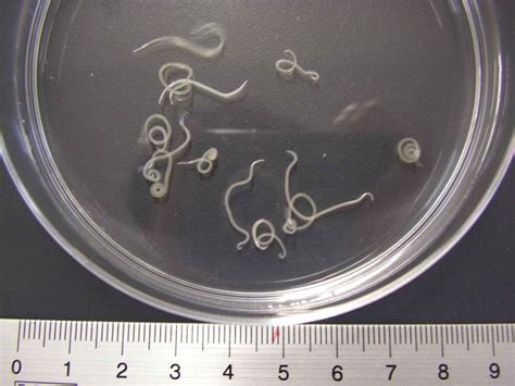 Herring Worm Ihsan Lumsdens Marine Invertebrates Project