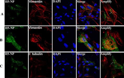 Subcellular Distribution Of Cytoskeleton Proteins Vimentin And Tubulin