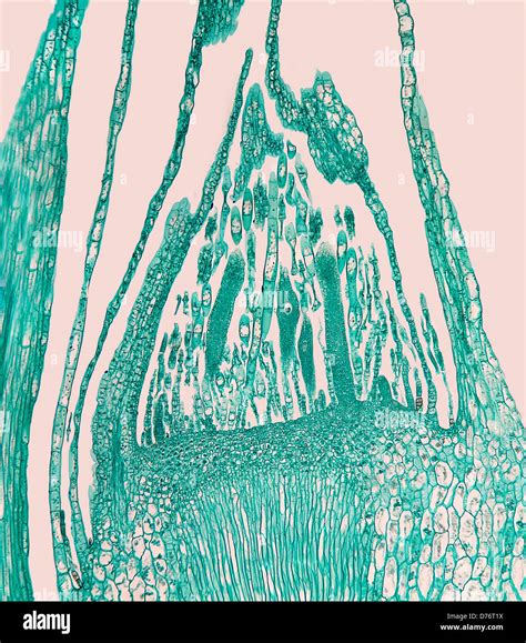 Moss Archegonial Head