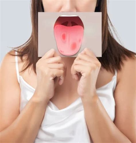 Patología Oral ORAL COOP