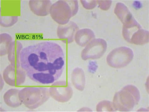 Cell Detection Wbc A And B Rbc C And D And Platelets E And F