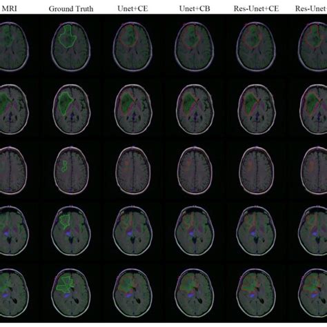 Predictions Of Models And Ground Truth On Samples Download