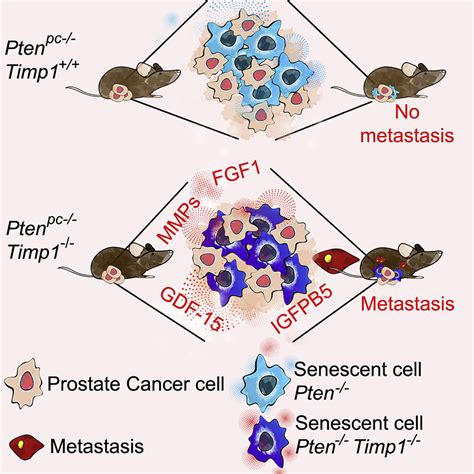 Senescence Reprogramming By Timp1 Deficiency Promotes Prostate Cancer