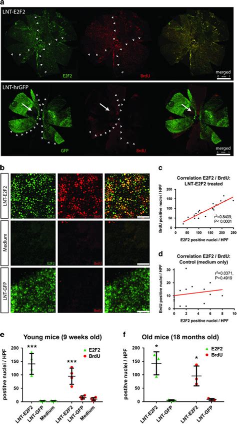 The Rpe Creer Dta Mouse Line Shows Reduced Rpe Cell Density Most