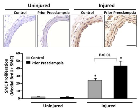 The Iris Jaffe Lab Graduate School Of Biomedical Sciences