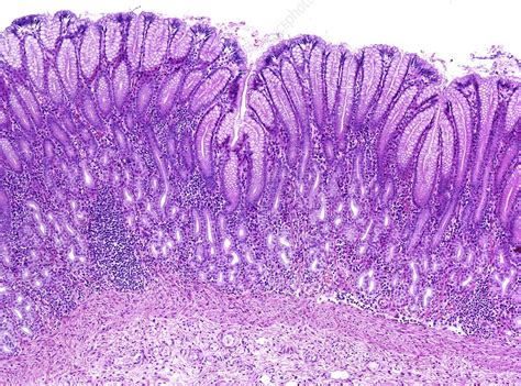 Stomach Light Micrograph Stock Image C023 9456 Science Photo Library