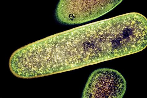 C Difficile Causes Symptoms Diagnosis Treatment And Prevention