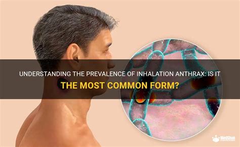 Understanding The Prevalence Of Inhalation Anthrax Is It The Most