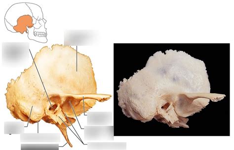 Temporal Bone Diagram Quizlet