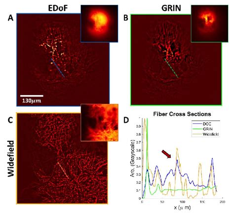 Extended Depth Of Field In A Fluorescent Fiber Sample A A