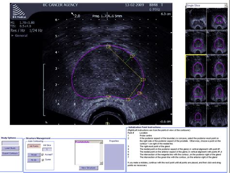 a snapshot of the graphical user interface for automatic prostate download scientific diagram