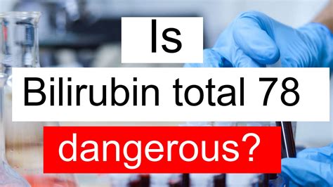 Is Serum Bilirubin Total 78 High Normal Or Dangerous What Does Serum Bilirubin Total Level 78