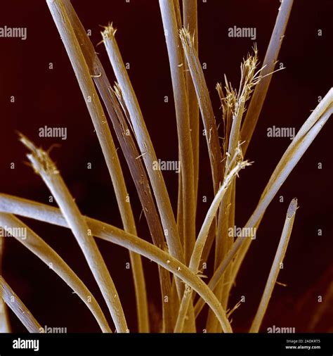 Split Hair Coloured Scanning Electron Micrograph Sem Of Human Hair