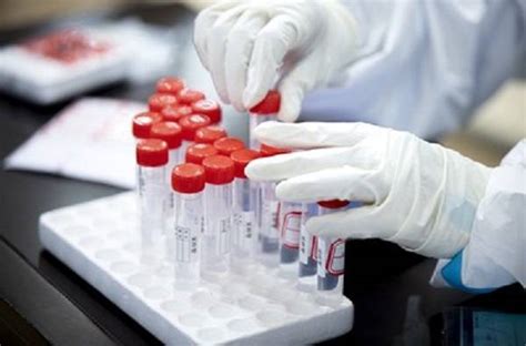 新民快评 这位确诊者的做法，因何被频频点赞？疫情防控上海