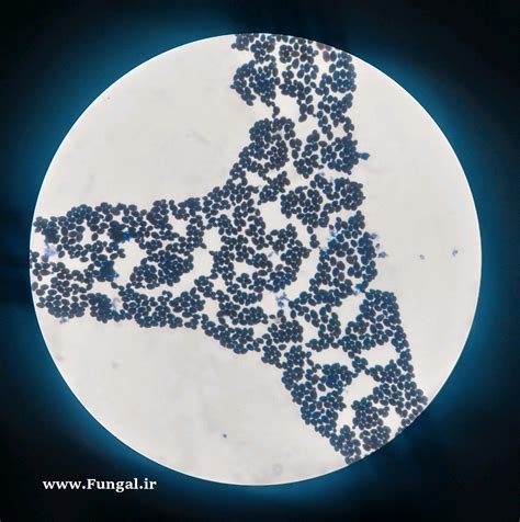 Trichophyton Rubrum Fungal