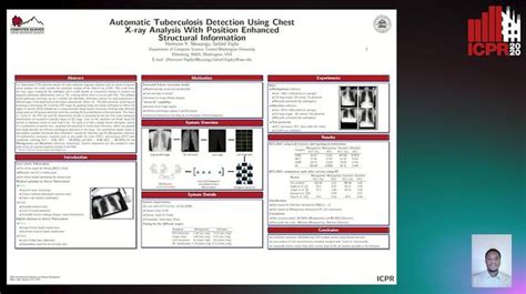 underline automatic tuberculosis detection using chest x ray analysis