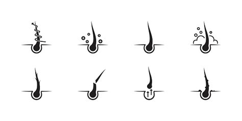 모발 치료 및 문제 머리카락 아이콘 집합입니다 탈모 절편 강화 영양 및 다양한 모발 관리 가위에 대한 스톡 벡터 아트 및 기타 이미지 Istock