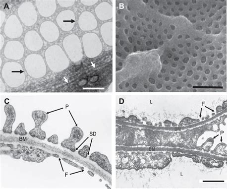 Figure 2 From Glomerular Endothelial Cell Fenestrations An Integral