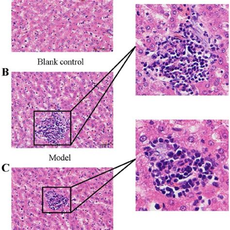Pathological Observation Of Liver Tissue In Different Groups