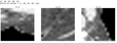 Pytorch Resnet3d预训练网络 Medmnist 3d医学数据分类medmnist数据集 Csdn博客