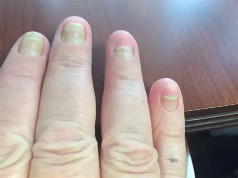 Your Nails Say Everything About You And Your Health In Palmistry Artofit