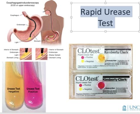 H Pylori Testing Flashcards Quizlet