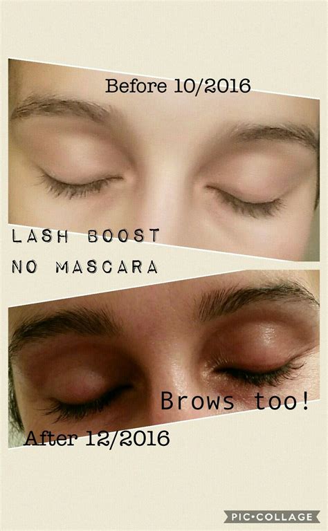 Before And After Lash Boost Rodanandfields Realresults Skincare