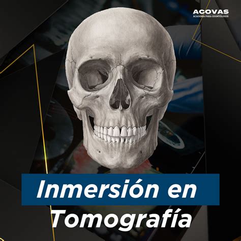 Inmersión en Tomografía ACOVAS Hotmart
