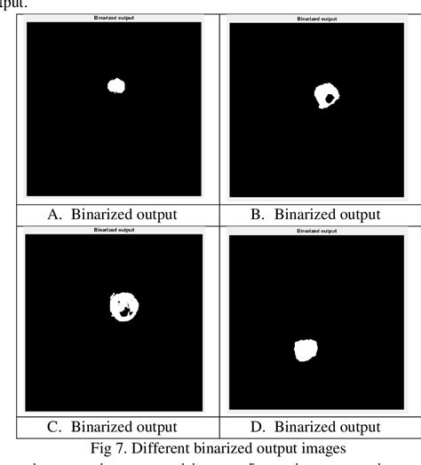 Figure 2 From A Deep Learning Approach For Semantic Segmentation In Brain Tumor Images