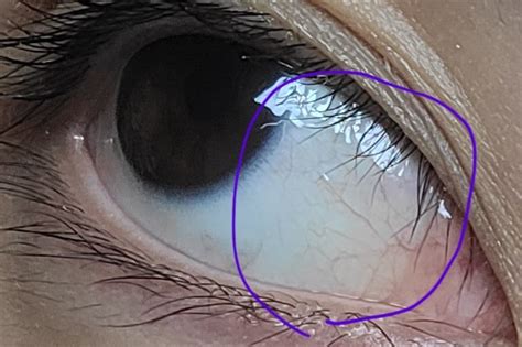 흰자 부분이 노란색 지식in