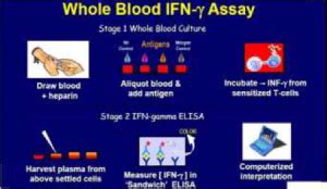 Understand The Significance Of QuantiFERON TB Gold Test