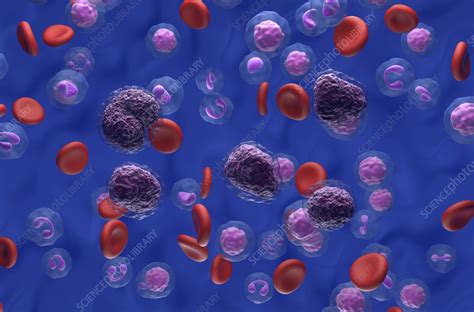 Non Hodgkins Lymphoma Cells Illustration Stock Image F0407222