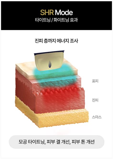더왈츠의원 티타늄리프팅