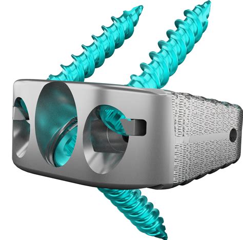 Anterior Lumbar Interbody Fusion Alif Atec Spine