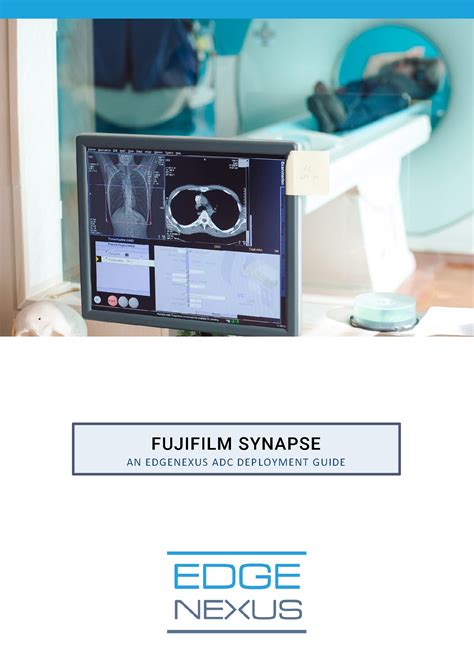 Load Balance Fujifilm Synapse Edgenexus Load Balancers And