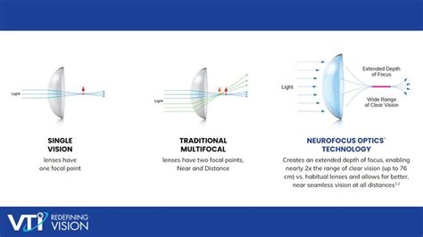 Understanding The Naturalvue Multifocal Contact Lens Myopia Profile