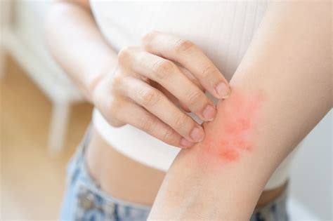 冬天老是皮膚癢醫師曝5招解決冬季癢洗完澡乳液要這樣塗抹最有效 女人我最大