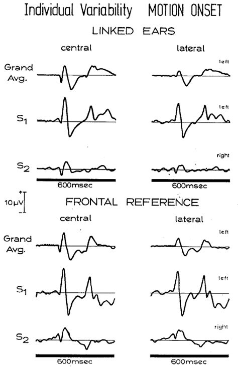 Individual Variability Of Visually Evoked Potentials Motion Onset The