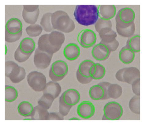 a cht rbcs detection results and b our proposed method rbcs