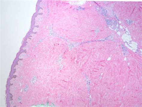 Surgpath4u Case Viewer