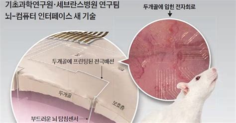 쥐 두개골에 인쇄한 전자회로뇌질환 치료에 ‘희망 시그널