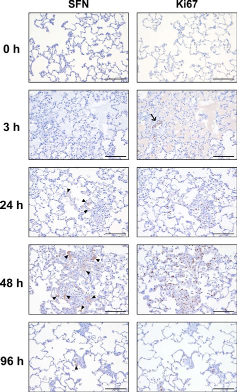 Analysis Of Stratifin Expression And Proteome Variation In A Rat Model