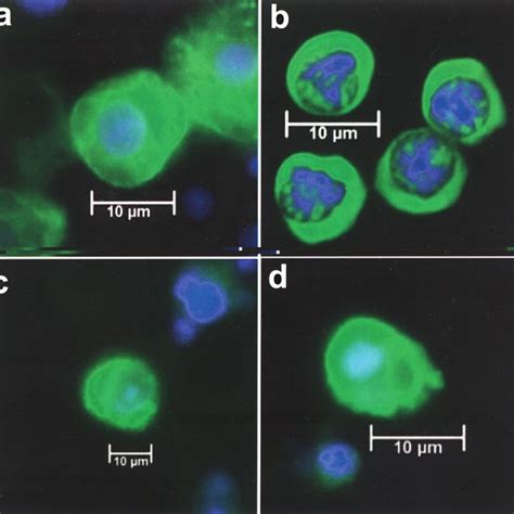 Liver Specific Gene Expression Analysis By Immunocytochemistry Of