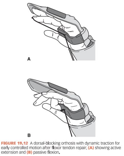 Tendon Injuries Repair Protocol Flashcards Quizlet