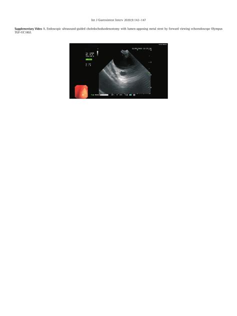 Pdf Recent Development Of Endoscopic Ultrasound Guided Biliary Drainage